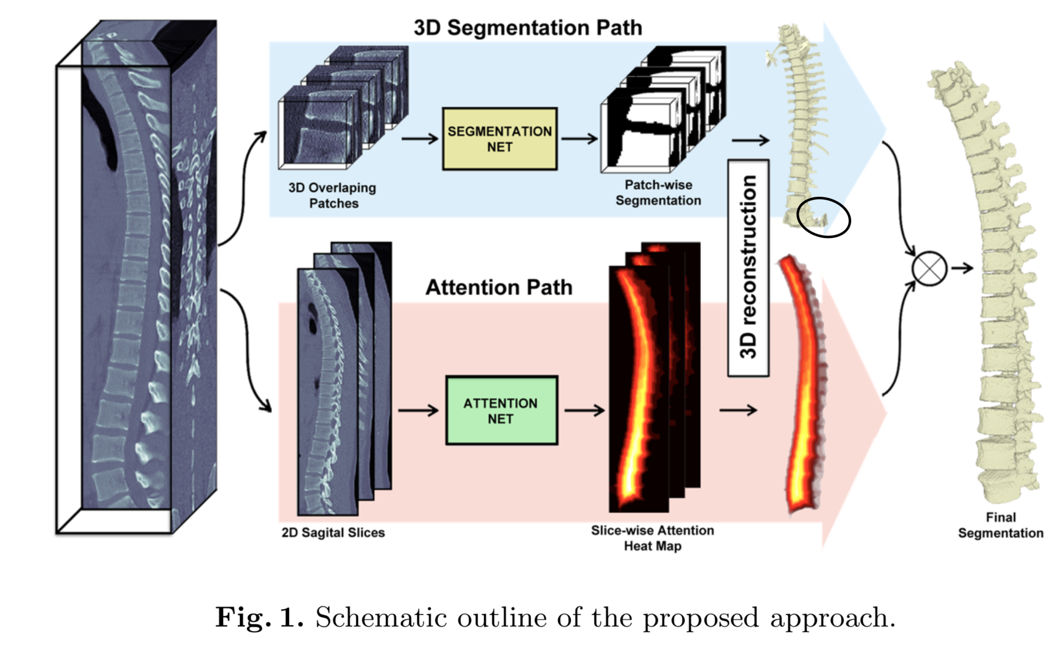 Attention-Driven Deep Learning for Pathological Spine Segmentation-CSDN博客