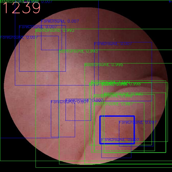RPN output proposal's score · Issue #5567 · open-mmlab/mmdetection · GitHub